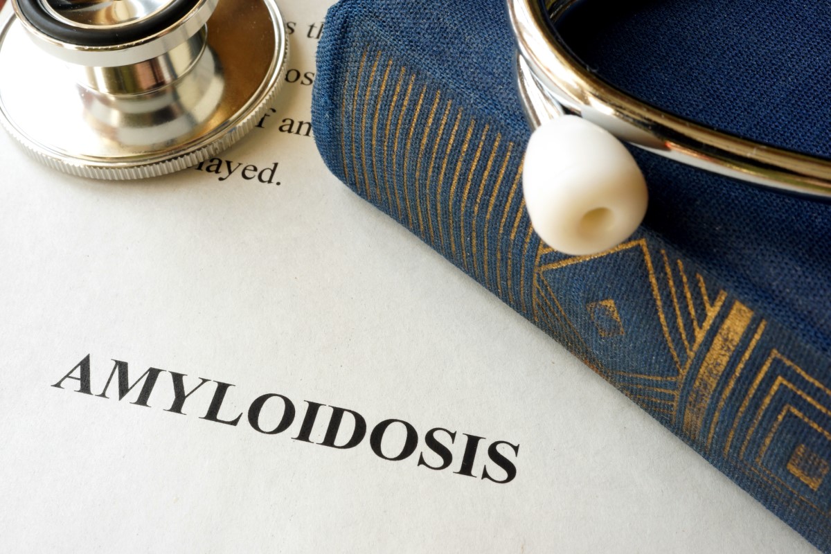Amylo dose Qu est ce Que C est Pourquoi Cela Se Produit il Quels
