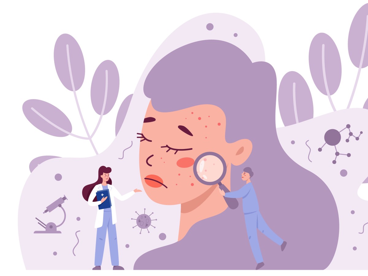 Traitement du carcinome basocellulaire : Comment le carcinome ...