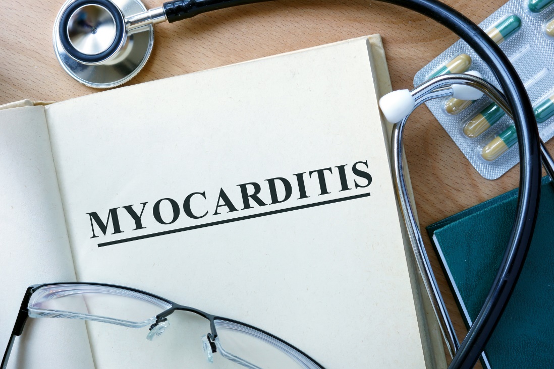 Myocardite : inflammation du muscle cardiaque. Infarctus du myocarde ...