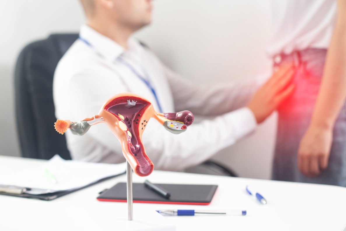 Myome de l'utérus : cause, symptômes, est-il dangereux pour la femme ...