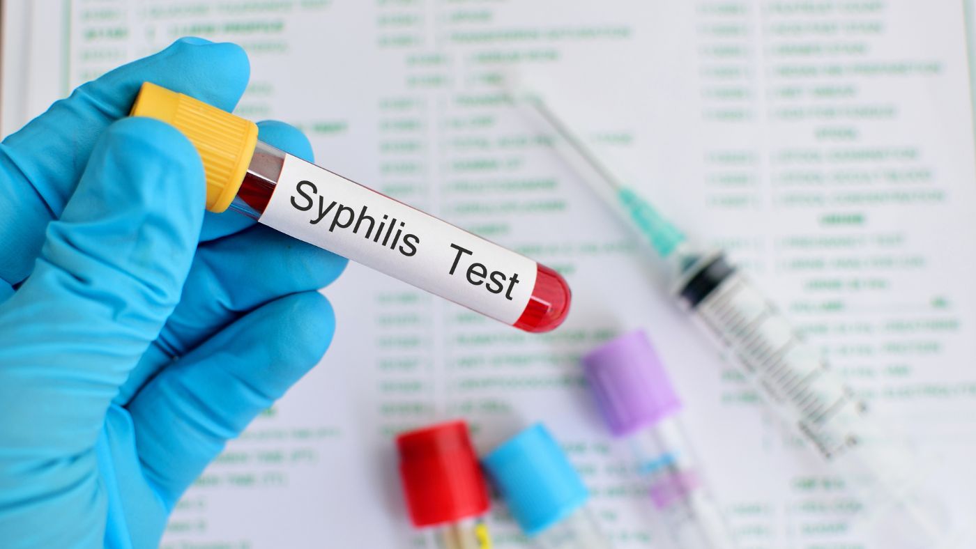 Traitement de la syphilis : d'abord des antibiotiques et d'autres ...