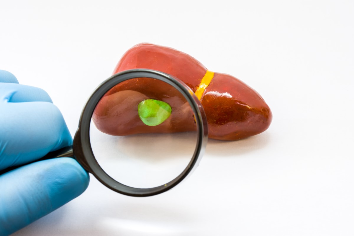 Bile et vésicule biliaire : quelles sont leurs fonctions ? La formation ...